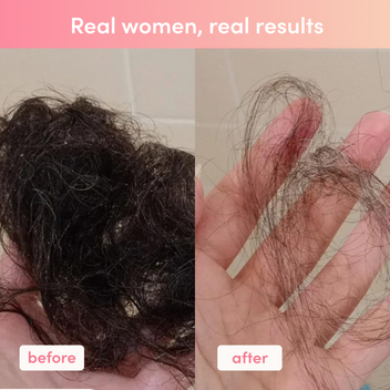 Collagen For Hair | Collagen Supplement for Hair Growth – The Collagen ...